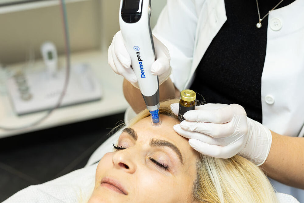 Dermapen 4: de échte alleskunner - JV Clinic